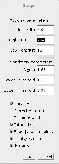 File:Ridge Detection Parameters.png - ImageJ